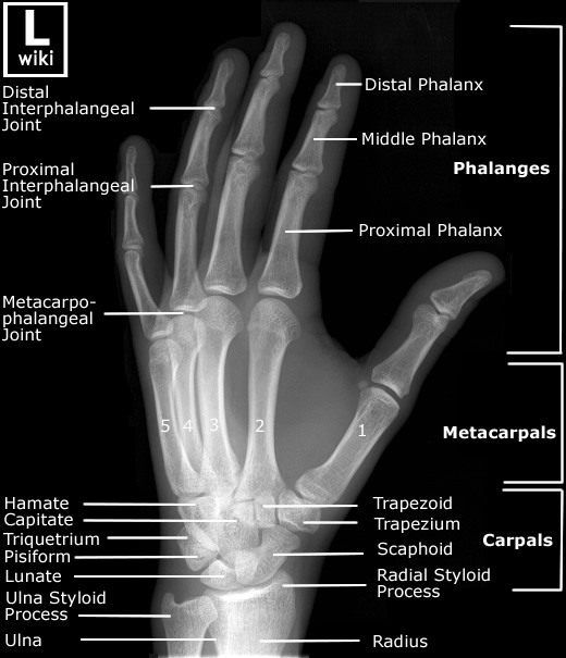 Radiographic Anatomy of the Hand – RADIOLOGYPICS.COM
