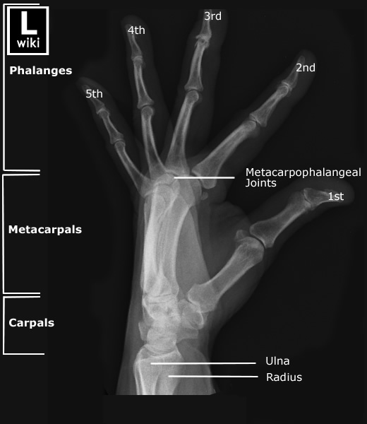 Radiographic Anatomy of the Hand – RADIOLOGYPICS.COM